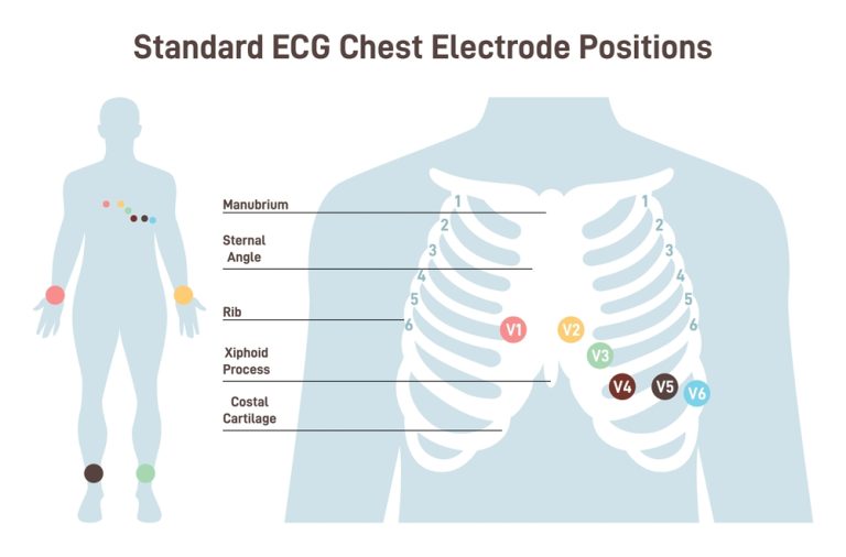 Electrocardiogram (EKG or ECG) Tests: Purpose, Types & Risks