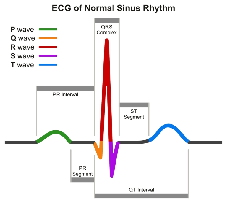 Electrocardiogram (EKG or ECG) Tests: Purpose, Types & Risks
